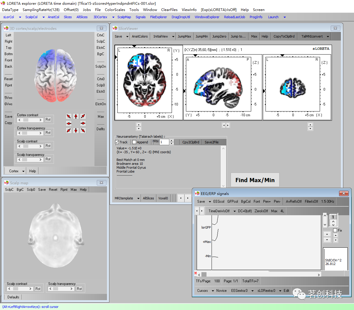 基于LORETA的EEG静息态脑网络分析 - 知乎