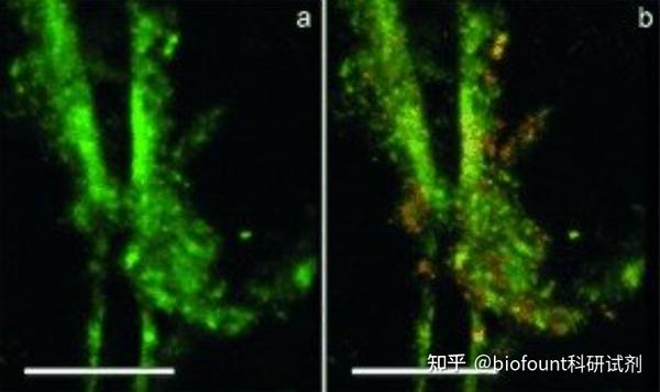 Hexidium Iodide(碘化己啶)；核酸染色剂 - 知乎