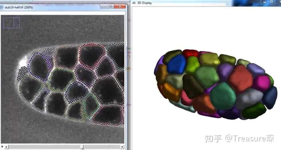 ImageJ实用技巧——3D细胞自动分割(插件篇) - 知乎