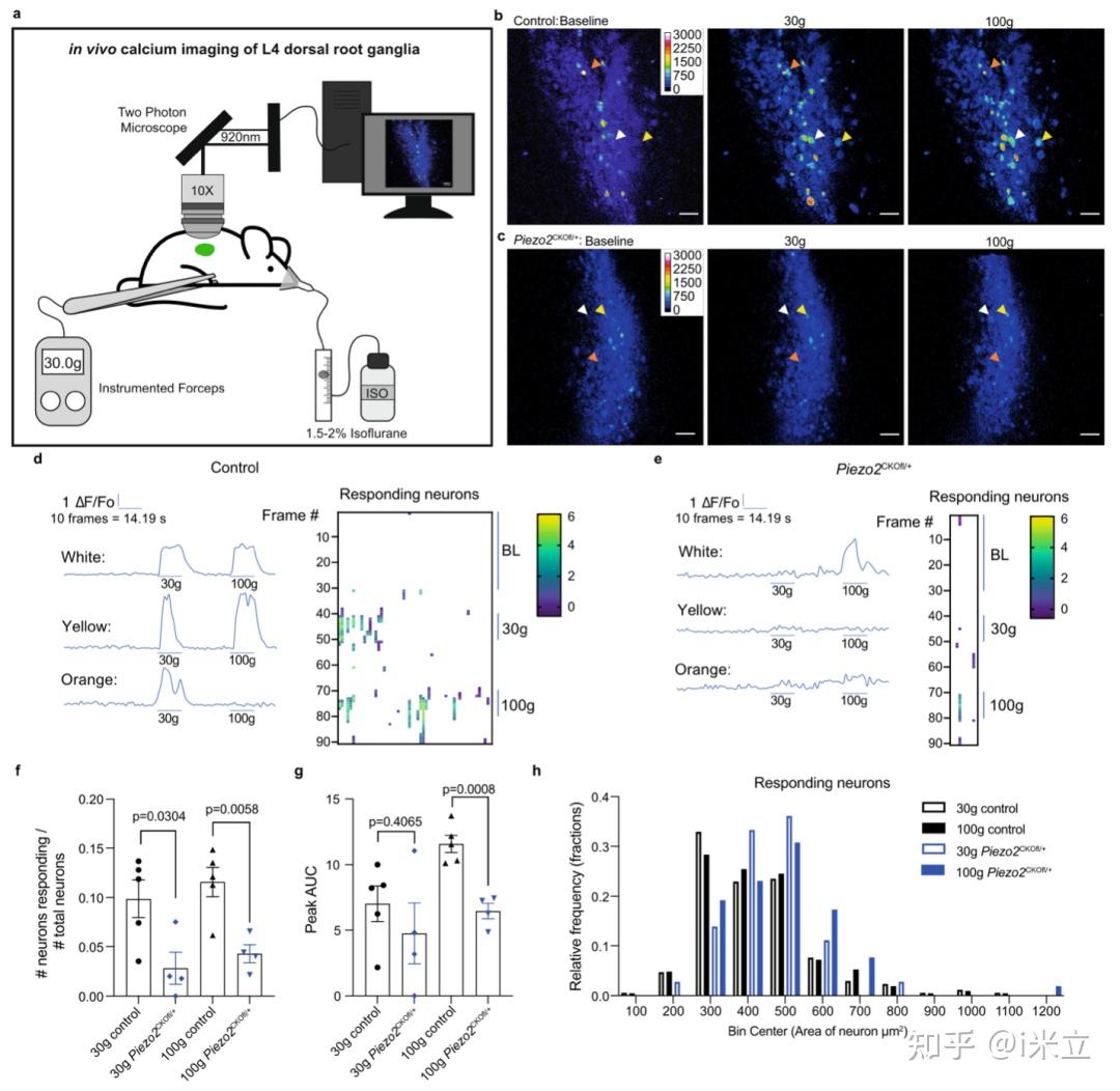 IF:17.694|Piezo2：一个治疗骨关节炎疼痛的新靶点 - 知乎