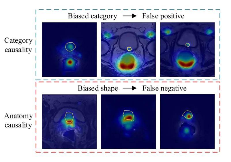 CNN 可视化：从 CVPR22 的出发，聊聊CAM是如何激活我们文章的热度 - 知乎