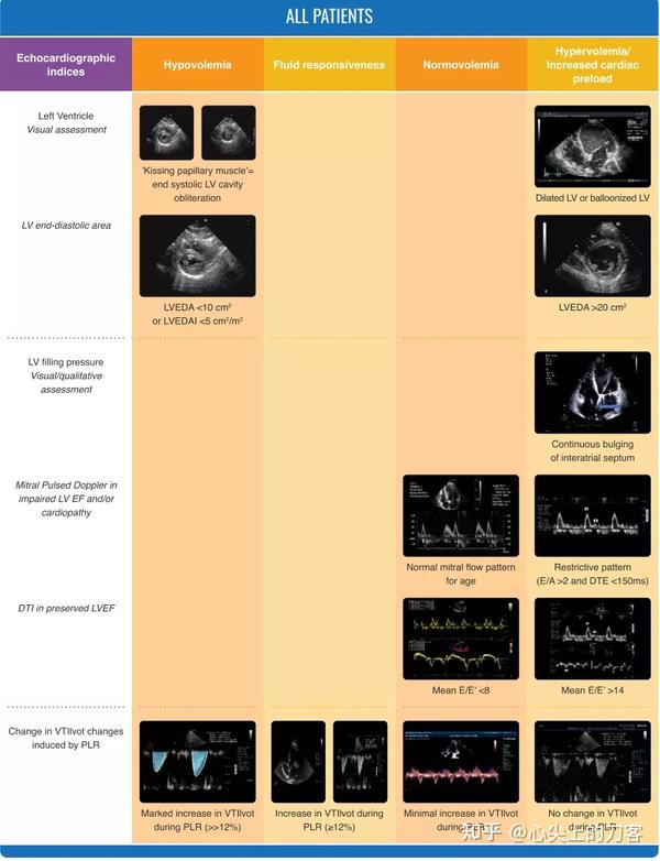 ICM综述：评估血流动力学如何帮助评估容量状态？ - 知乎
