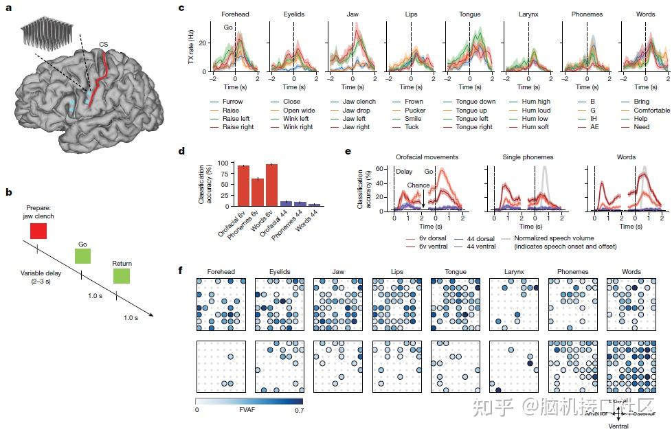 脑机接口里程碑！一天2篇Nature！让无法发声患者意念交流 - 知乎