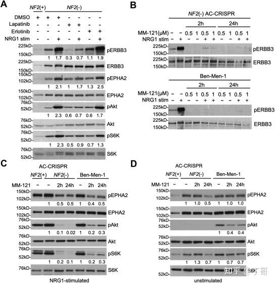 mTOR 激酶抑制破坏神经调节蛋白 1-ERBB3 自分泌信号并使NF2缺陷脑膜瘤细胞模型对 IGF1R 抑制敏感 - 知乎
