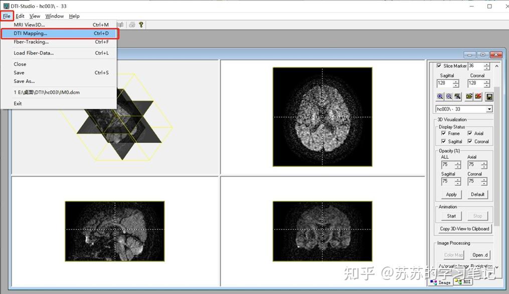 DTI Studio操作教程 - 知乎