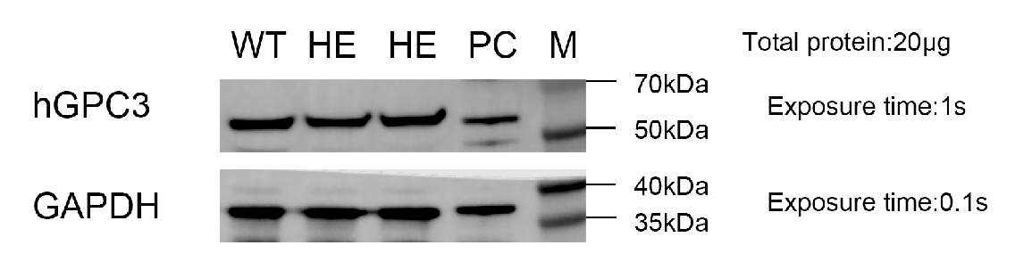 细说肝癌治疗潜力靶点--GPC3 - 知乎