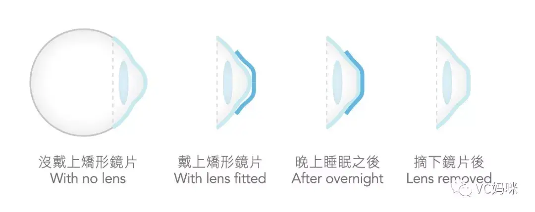 关于OK镜，你想知道的一切都在这里（上） - 知乎