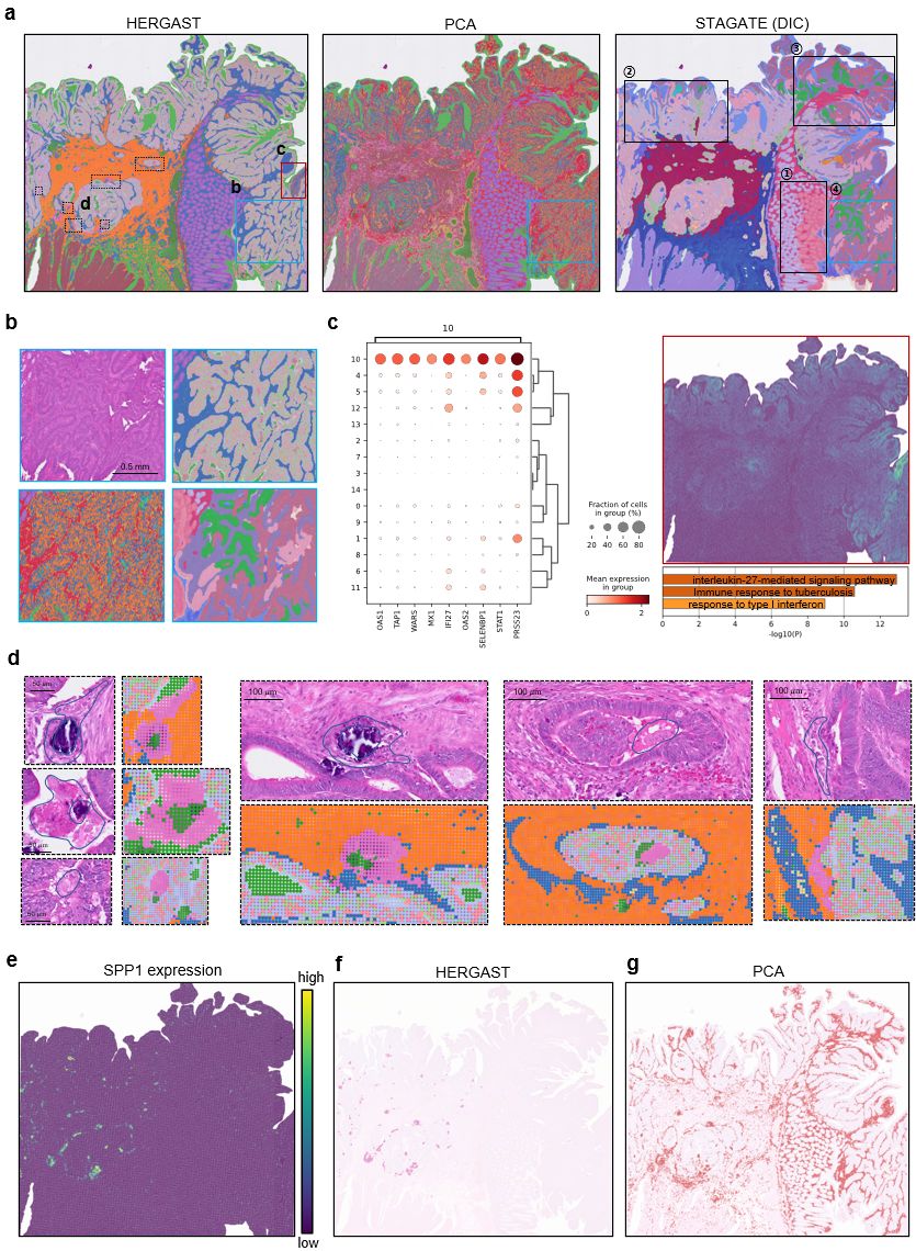 Nat Commun | 上海交大团队开发HERGAST，破解超大规模空间转录组分析难题 - 知乎