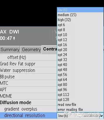 DTI技术原理及临床应用 - 知乎