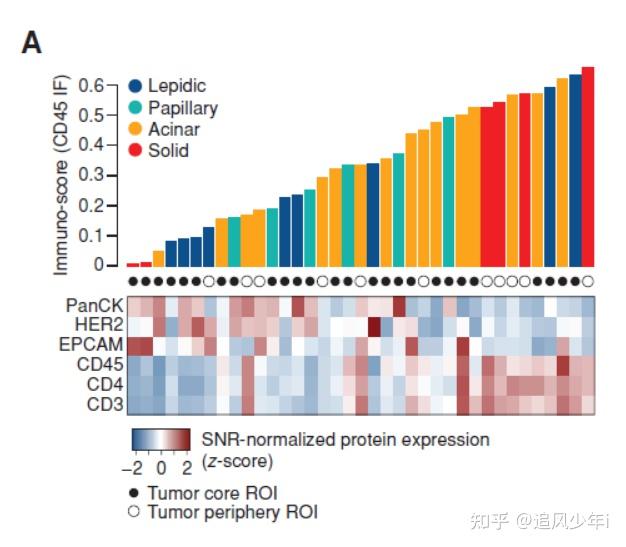 单细胞 & DSP(Digital Spatial Profiler)联合分析解析肺腺癌的转录重编程推动cancer evolution - 知乎