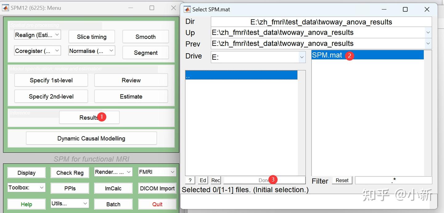 13-SPM-fmri任务态 二阶分析：多因素方差分析 - 知乎