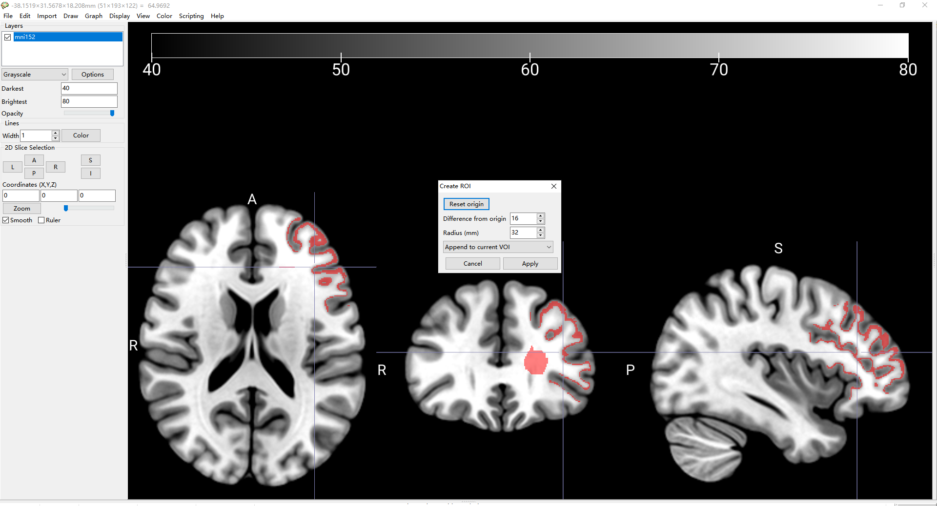 DICOM 图像浏览器和影像科研平台推荐（附 Radiant Viewer、3D Slicer 安装包） - 知乎