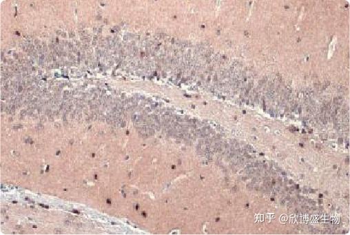 用于少突胶质细胞转录因子 2 Olig2 的兔单克隆重组抗体 知乎