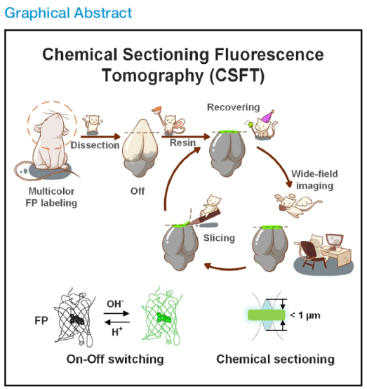 CSFT——全脑成像技术再迎革新 - 知乎