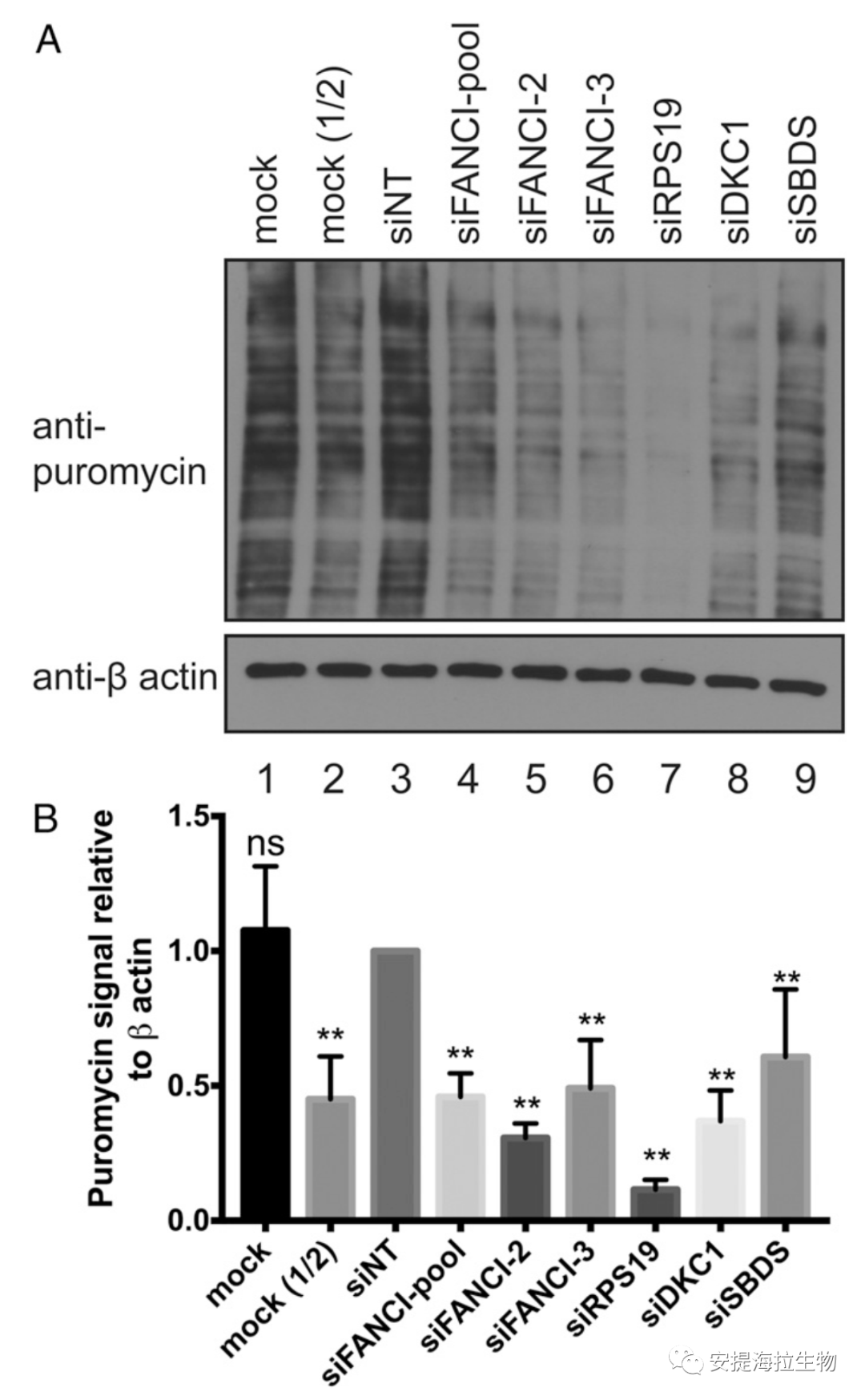 FA蛋白FANCI在核糖体的生物合成中发挥作用 - 知乎