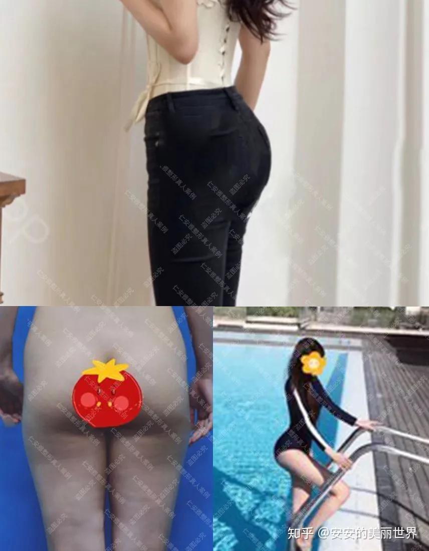 丰臀术火辣美臀女郎,浑圆上翘的臀部更能体现女性的曲线! 知乎
