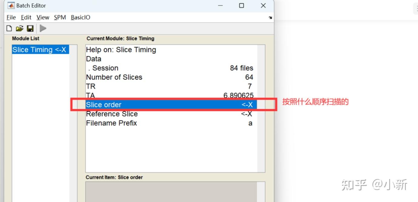 3-spm-fMRI任务态数据分析——预处理（下） - 知乎