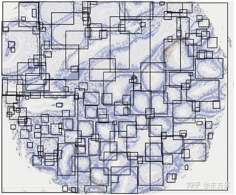ImageJ | 免疫组织化学（IHC）图像分析工具箱 | 下载地址 | 安装教程 | 使用教程 - 知乎