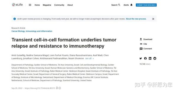 肝癌治疗后还复发？癌细胞最怕你知道这4大“套路”！ - 知乎