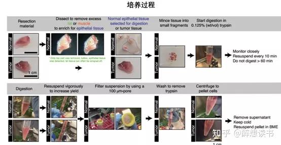 肿瘤类器官如何培养？Hans Clevers大佬在Nature Protocols分享详细方法！ - 知乎