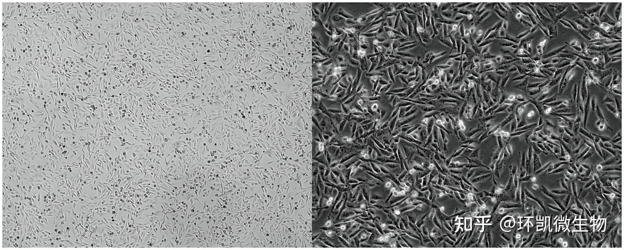 细胞攻略 | MDA-MB-231(人乳腺癌细胞)培养教程 - 知乎