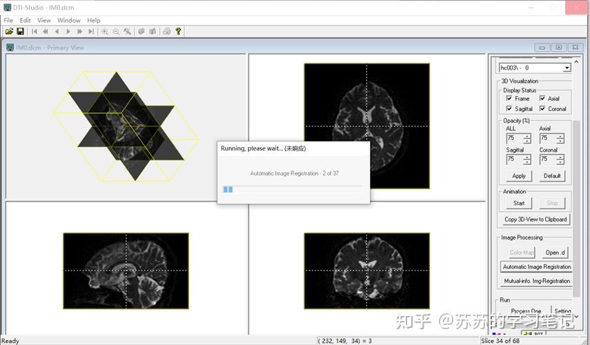 DTI Studio操作教程 - 知乎