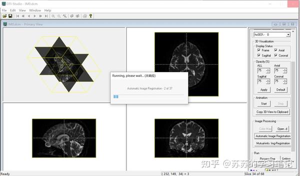 DTI Studio操作教程 - 知乎