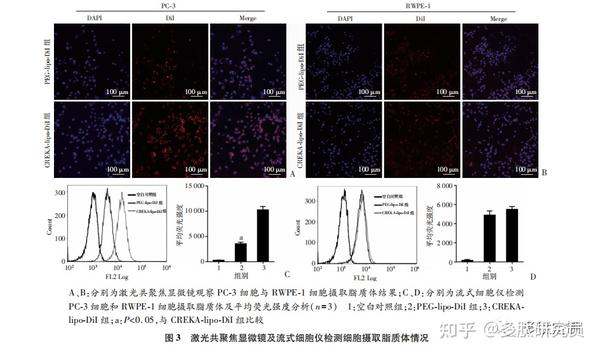 CREKA肽修饰的载多西他赛脂质体抗前列腺癌靶向研究 - 知乎