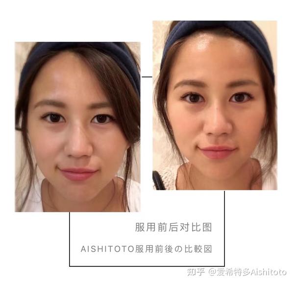 爱希特多AISHITOTO神奇的AIS-PAGE凝胶究竟是什么？ - 知乎