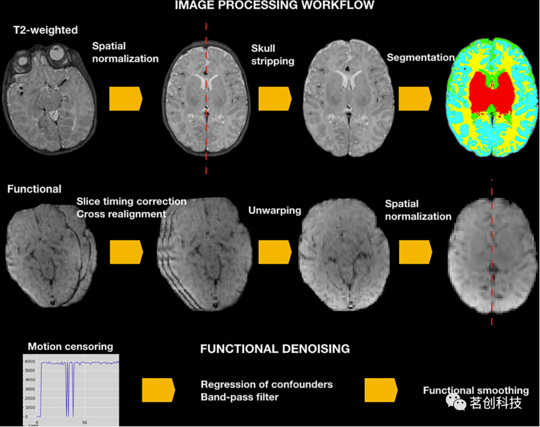 NeoRS：新生儿静息态fMRI数据预处理流程 - 知乎