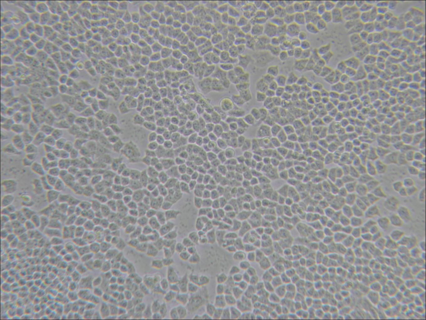 Huh-7-luc 肝癌细胞 - 知乎