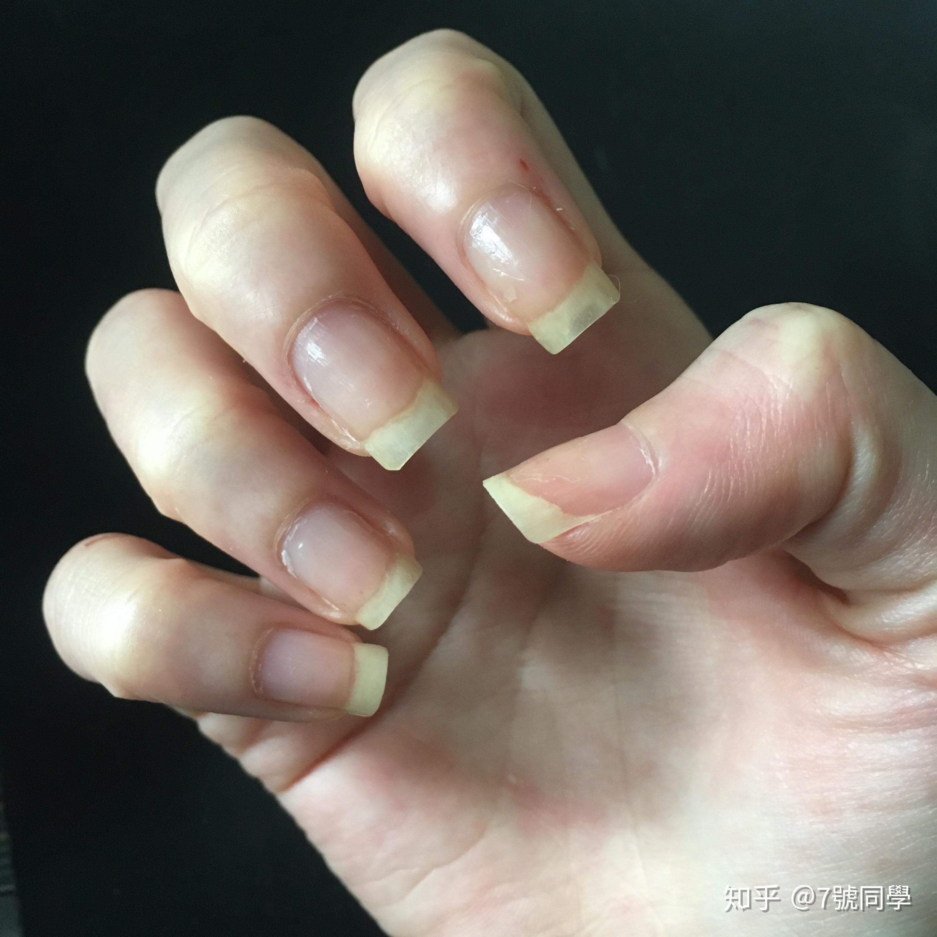 留长指甲会使甲床变长吗? 知乎