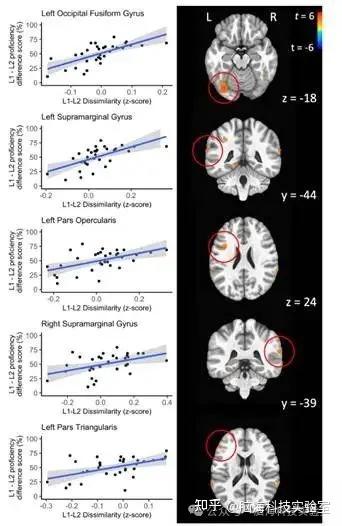 Hum Brain Mapp ：双语大脑如何分工？脑科学研究揭示语言表征奥秘 - 知乎