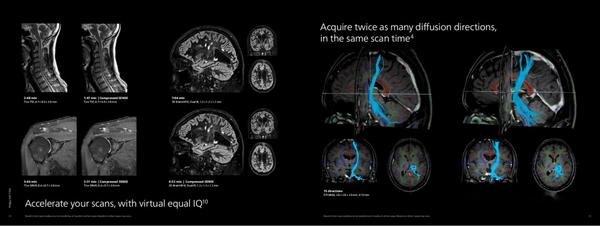 最新！飞利浦磁共振成像系统MR 7700获FDA批准 - 知乎