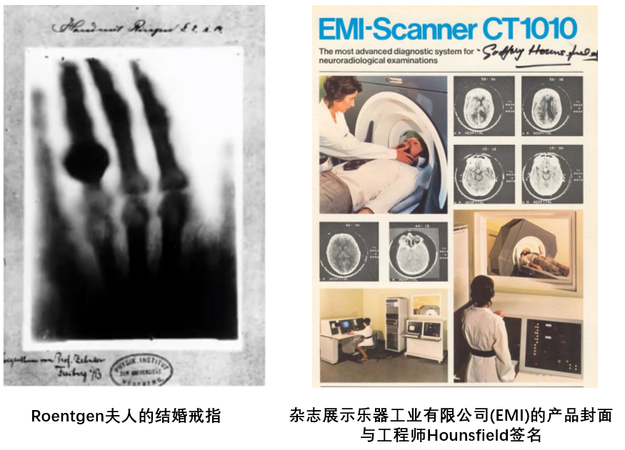 药效纵向研究新利器？Micro-CT影像技术在药物临床前小鼠药效模型上的应用 - 知乎