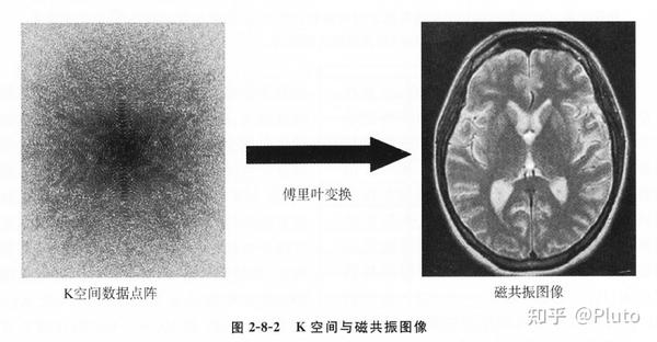 sMRI磁共振成像的物理学原理 - 知乎