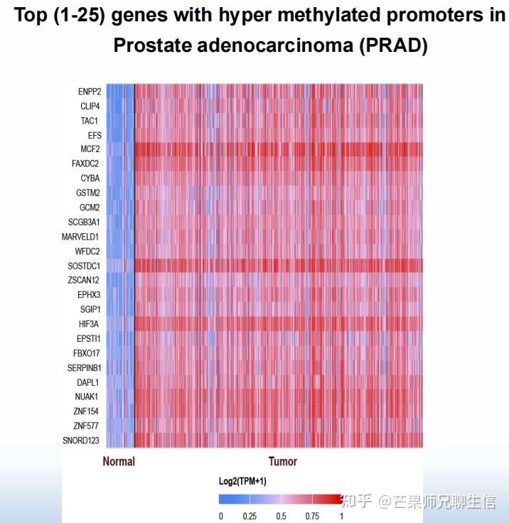 肿瘤免疫 · 实操教程Day10.UALCAN使用教程 - 知乎