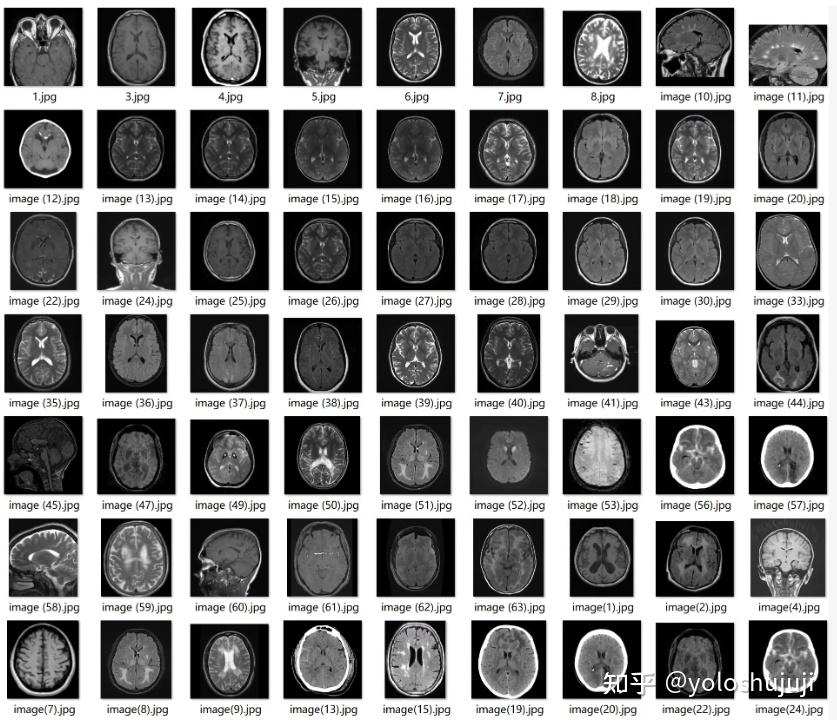 医学类数据集 脑肿瘤MRI图像检测数据集 5,249 张 MRI 图像，分为训练集和验证集。YOLO 格式 对应4类脑肿瘤标签。0 类：神经胶质瘤1 类：脑膜瘤2 类：无肿 3类：垂体 - 知乎