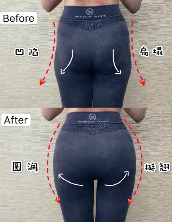 女生常见的5种臀型，哪种臀型最美？看看自己属于哪种 知乎 6906