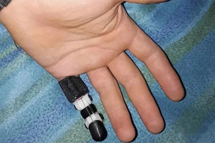 2023年最常见的3D打印义肢 - 知乎