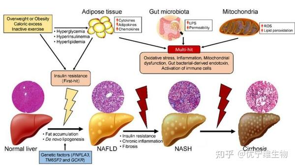 Systemic Immunity in NAFLD&NASH : Total Solution All in One - 知乎