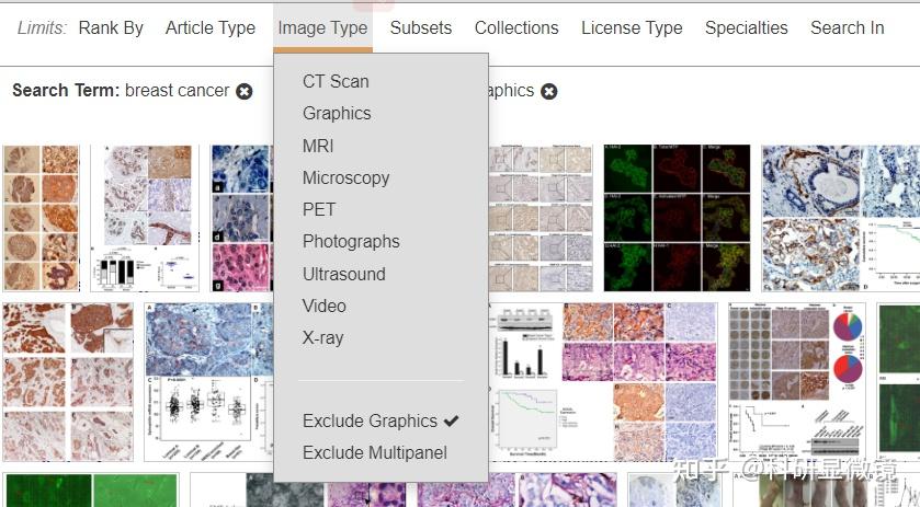 SCI写作-利用NCBI下的网页OPENI进行图片检索，制作高大上的流程图，反向检索文献 - 知乎