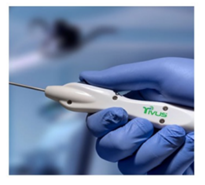 基于血管内超声的RDN代表性产品一览 - 知乎