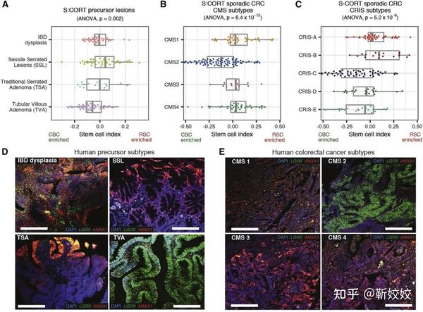 Cell Stem Cell | ISH、mIHC、scRNA-seq多技术确定“干细胞指数”——结肠癌化疗响应潜在评估指标 - 知乎