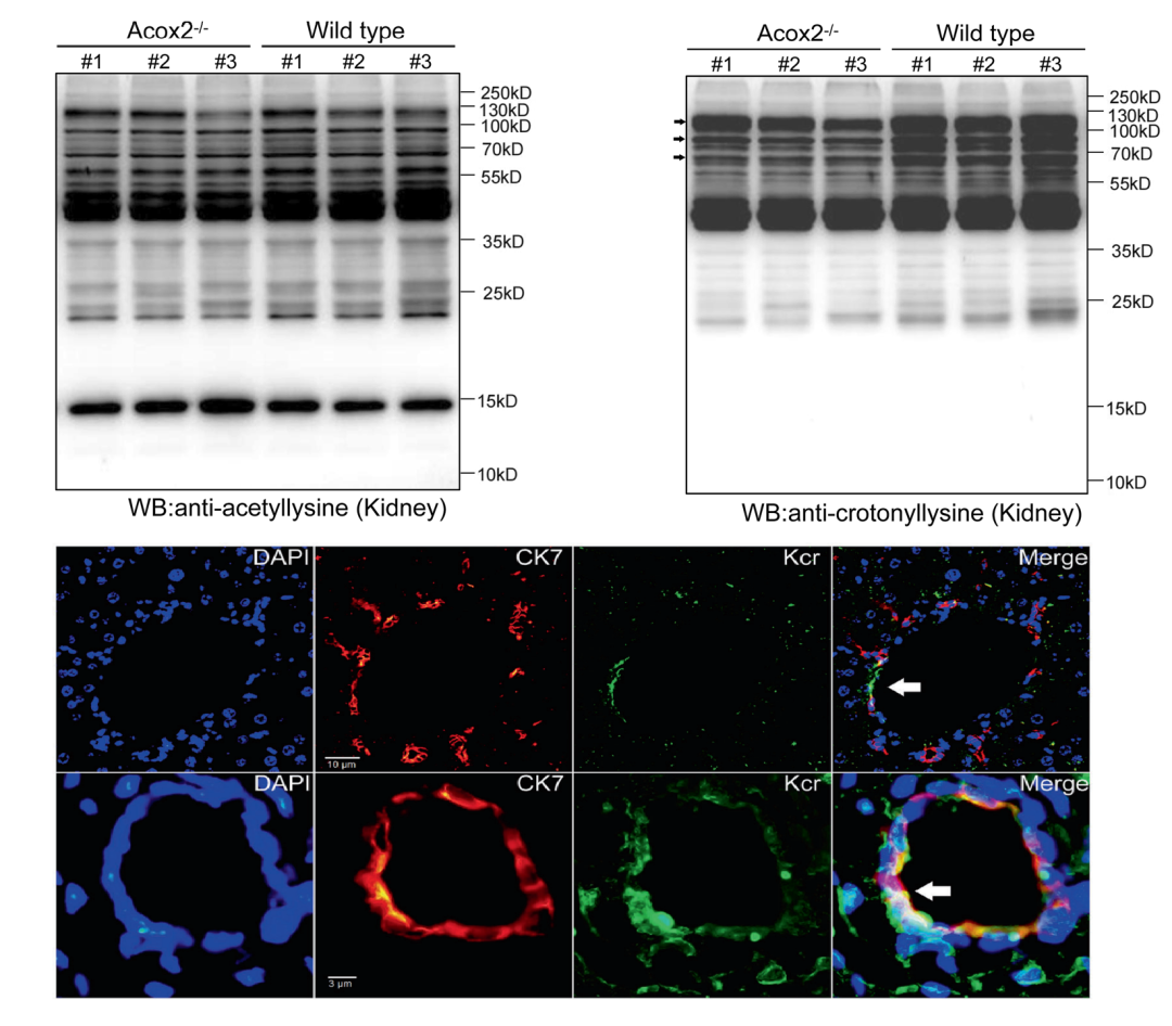 Cell Death Dis | 复旦大学周翔宇组报道ACOX2调控巴豆酰化修饰介导肝脏代谢稳态 - 知乎
