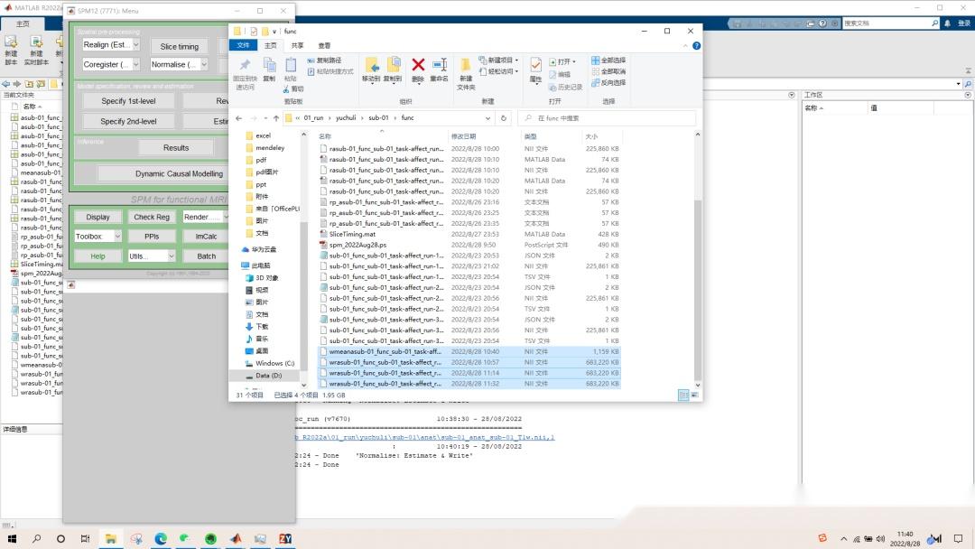 如何用SPM完成fMRI数据的预处理【任务态】 - 知乎