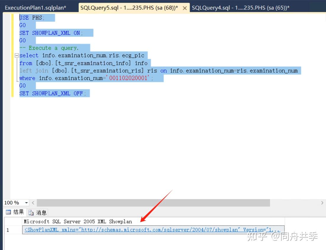 MSSQL.Tune.4.1：Execution Plan（执行计划） - 知乎