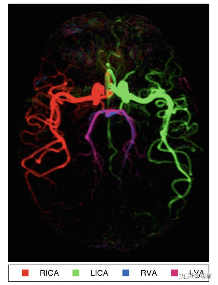 ASL 的最新技术发展：对最新技术的回顾 - 知乎