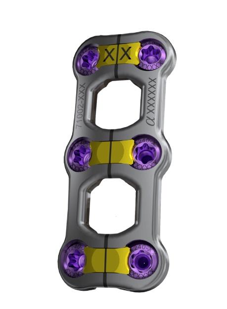 与医生协作开发，脊柱公司Alphatec - 知乎