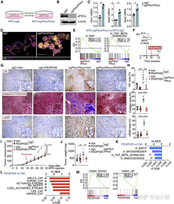 文献分享|Cancer Cell: 上皮细胞aPKCs缺失驱动的透明质酸重塑了肿瘤微环境并促进了间质型结直肠癌恶性表型 - 知乎